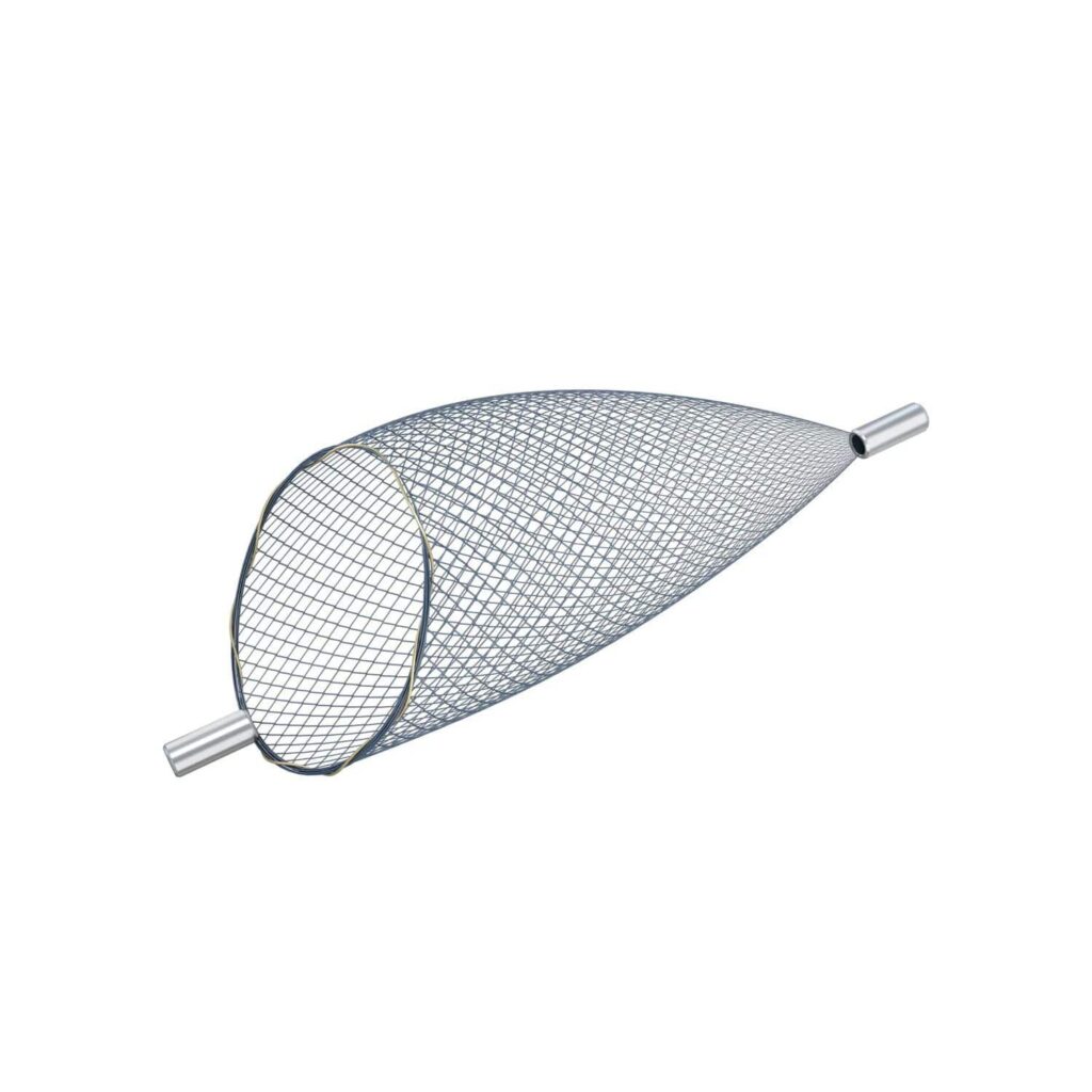 Carotid embolic protection system – Awc Concepts